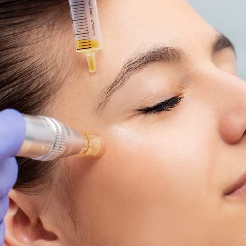 Plasma - Scalp Micro Sweden